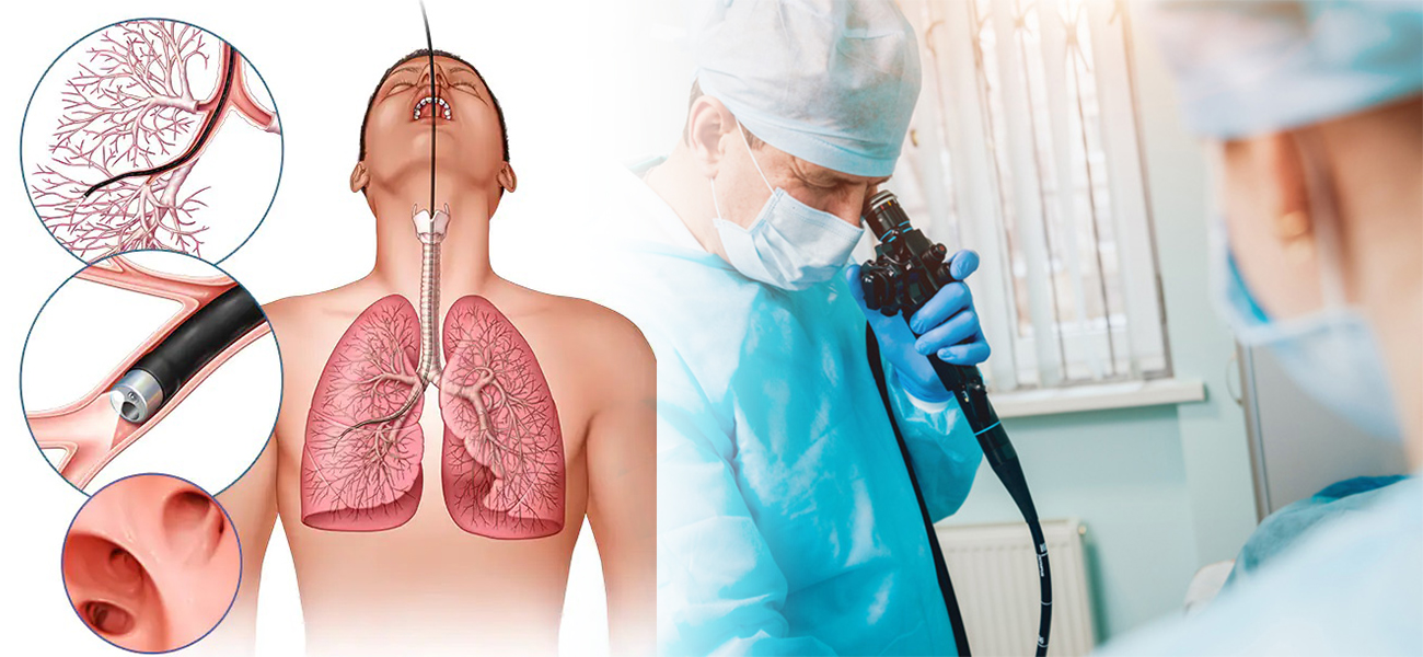 Bronchoscopy & Chest Medicine at Acme Hospital | Chembur | Navi Mumbai.