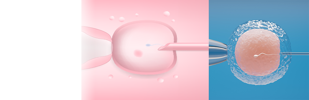 IVF & ICSI: Advanced Fertility Solutions at Acme Hospital